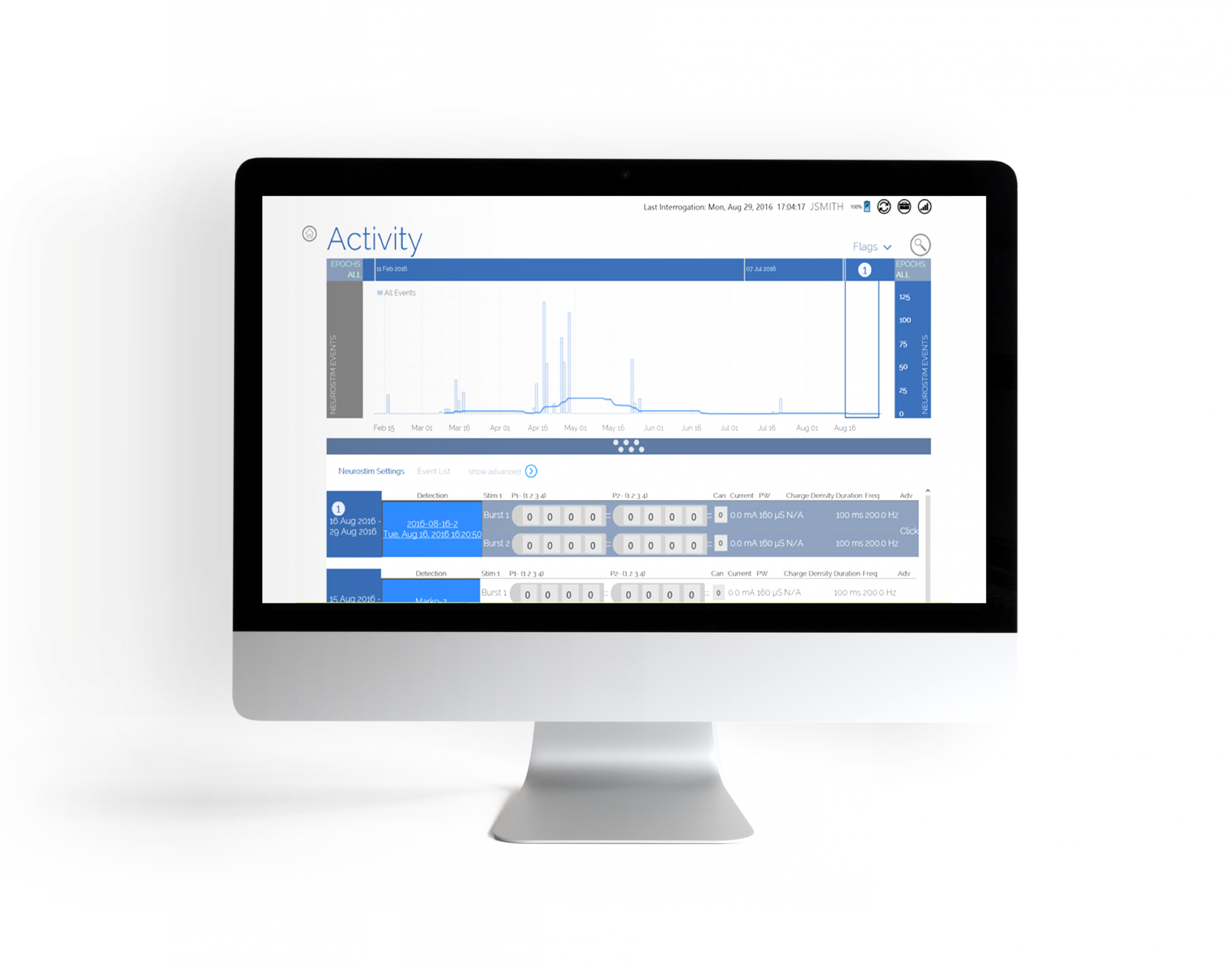 The RNS System | Personalized Neuromodulation Therapy