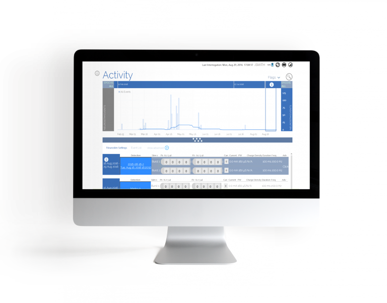 The RNS System | Personalized Neuromodulation Therapy