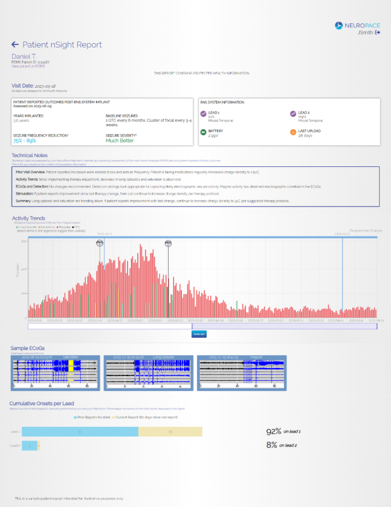 NeuroPace nSight Platform | Data Made Simple. Insights Made Clear.
